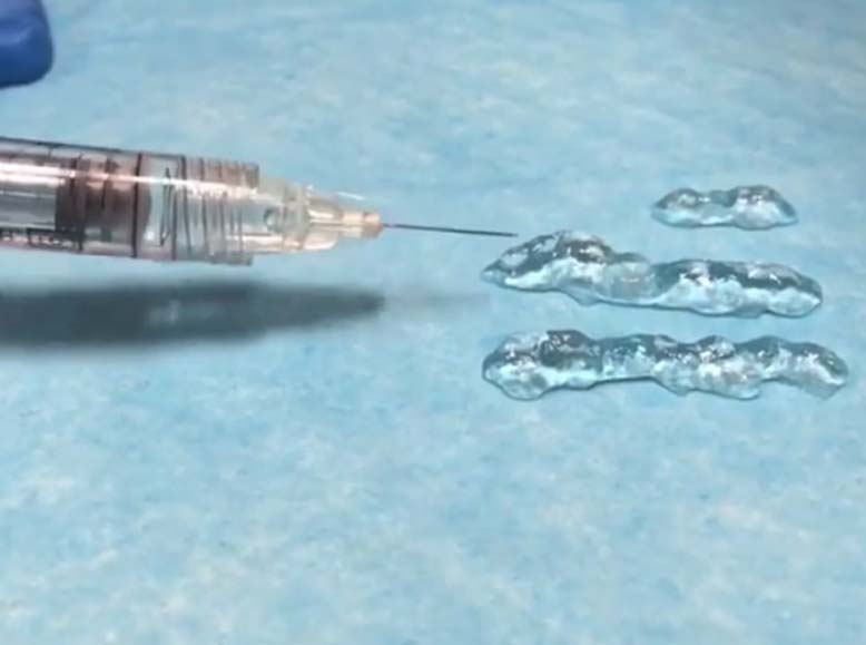 Fillers - Bay Aesthetics Clinic and Medispa