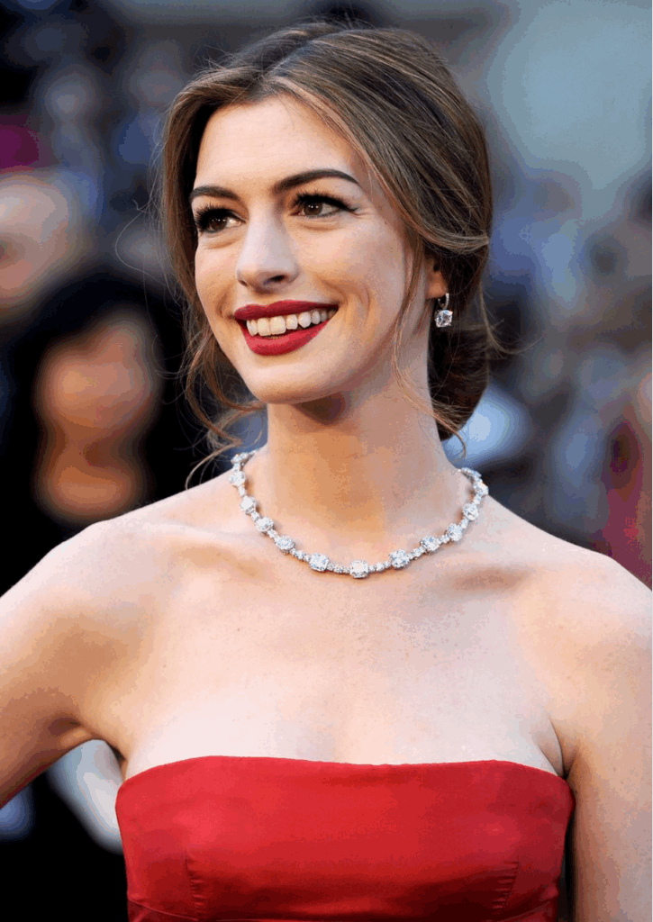 Trapezius Botulinum Toxin (TrapTox) Shoulder slimming injections - Bay ...
